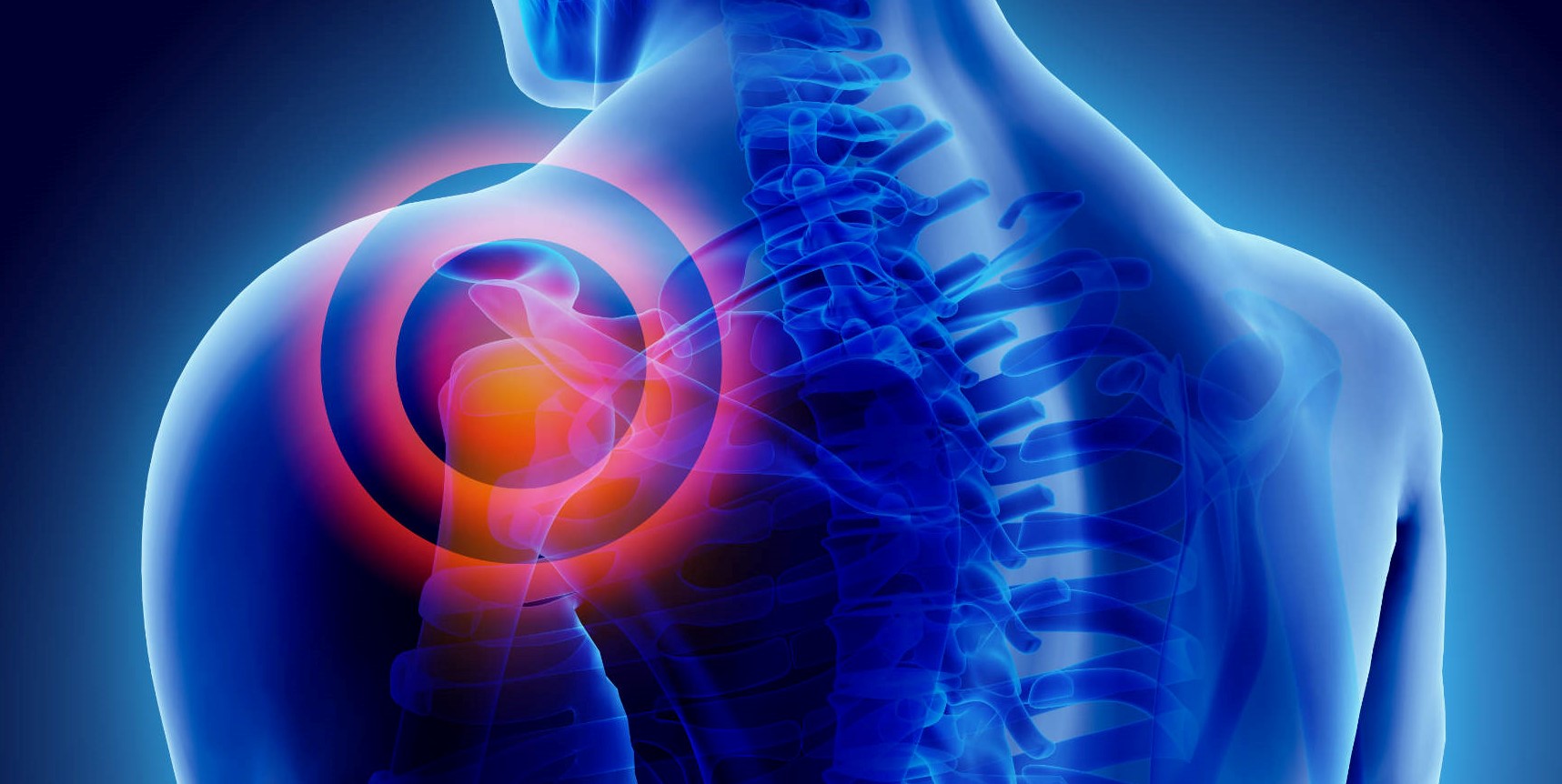 Practical Shoulder Day - SmartEducation